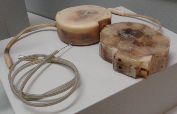 Spotlight Artifact: Pacemaker | The Buffalo History Museum Blog